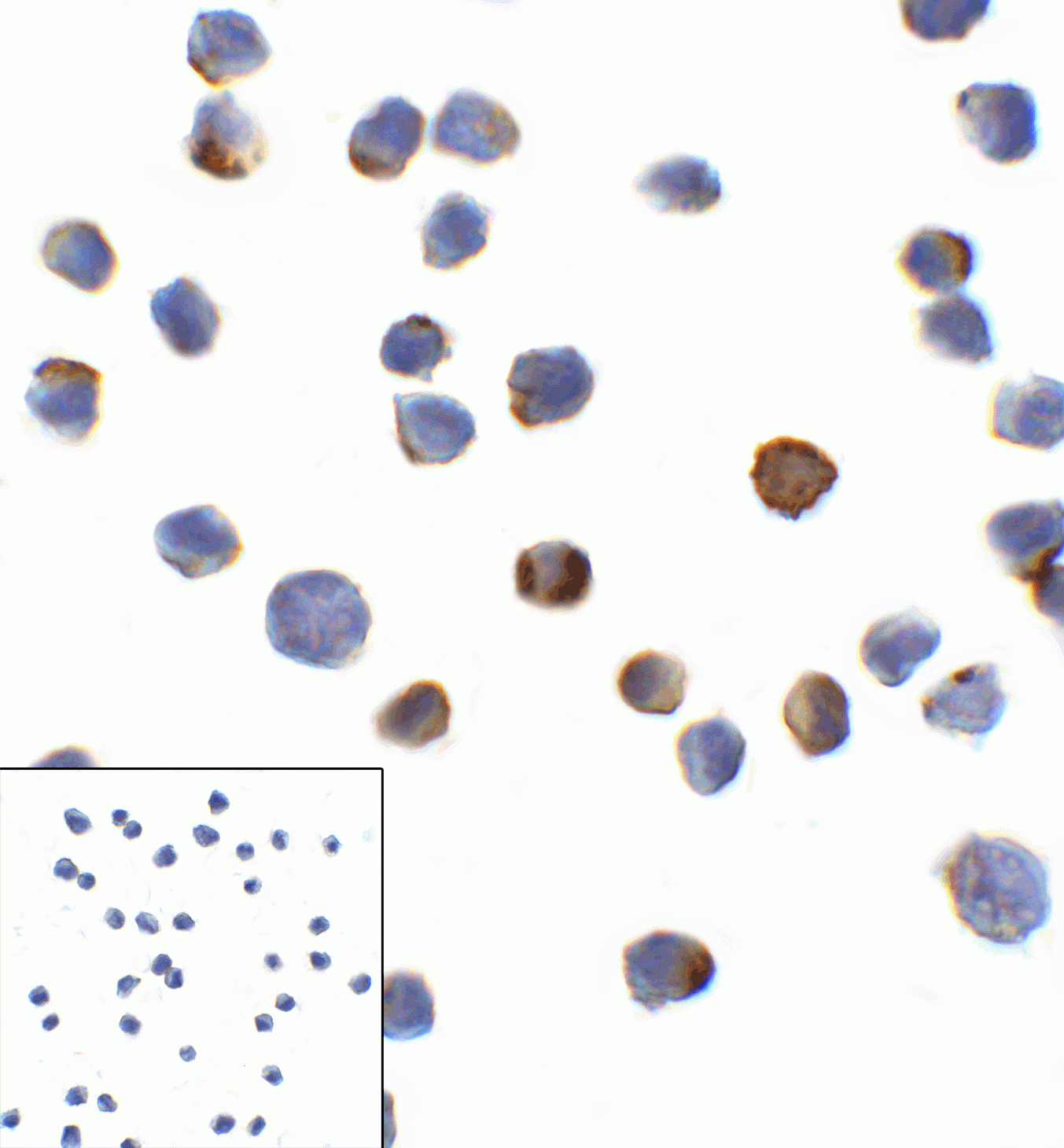 LAG3 Antibody [2G8] - Cat. No. RF16082 | ProSci