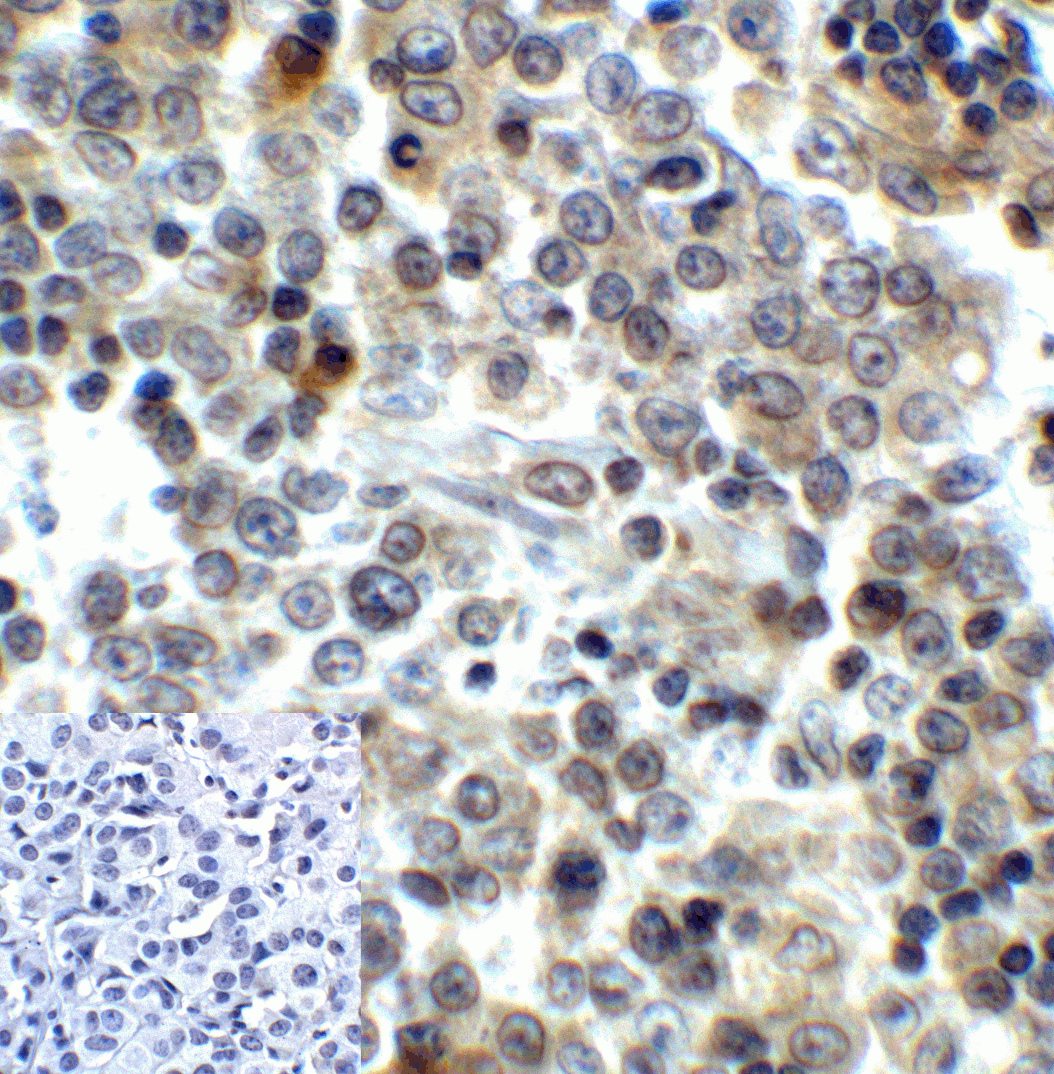 LAG3 Antibody [6B12] - Cat. No. RF16086 | ProSci