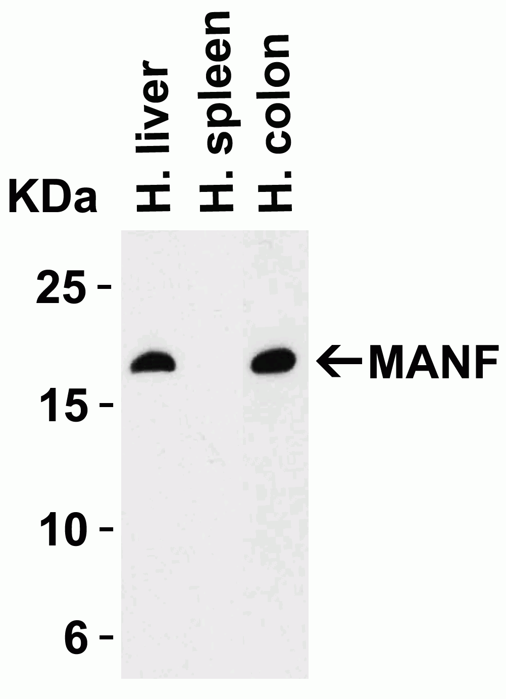 MANF Antibody - Cat. No. 4347 | ProSci