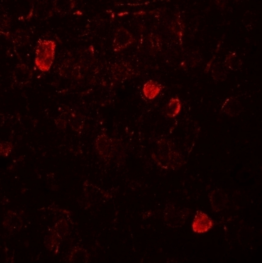 NELF Antibody - Cat. No. 7225 | ProSci