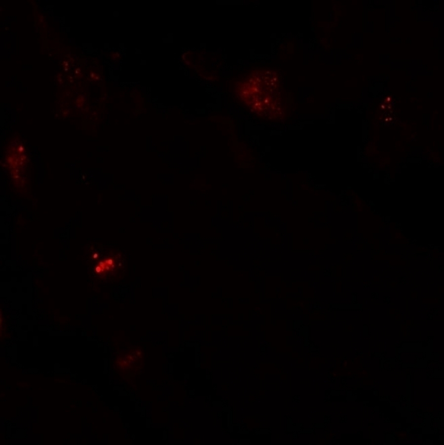 NIBRIN Antibody - Cat. No. 6839 | ProSci
