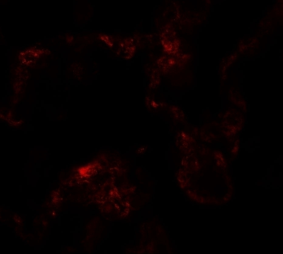 NIBRIN Antibody - Cat. No. 6841 | ProSci