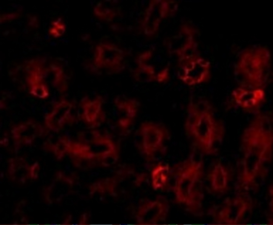 NOTUM Antibody - Cat. No. 5291 | ProSci