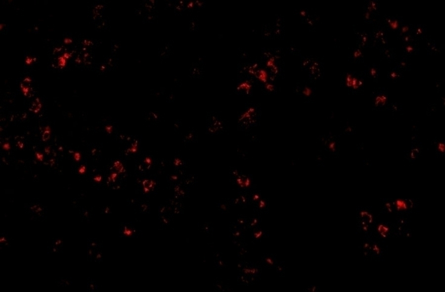 OCC-1 Antibody - Cat. No. 4997 | ProSci