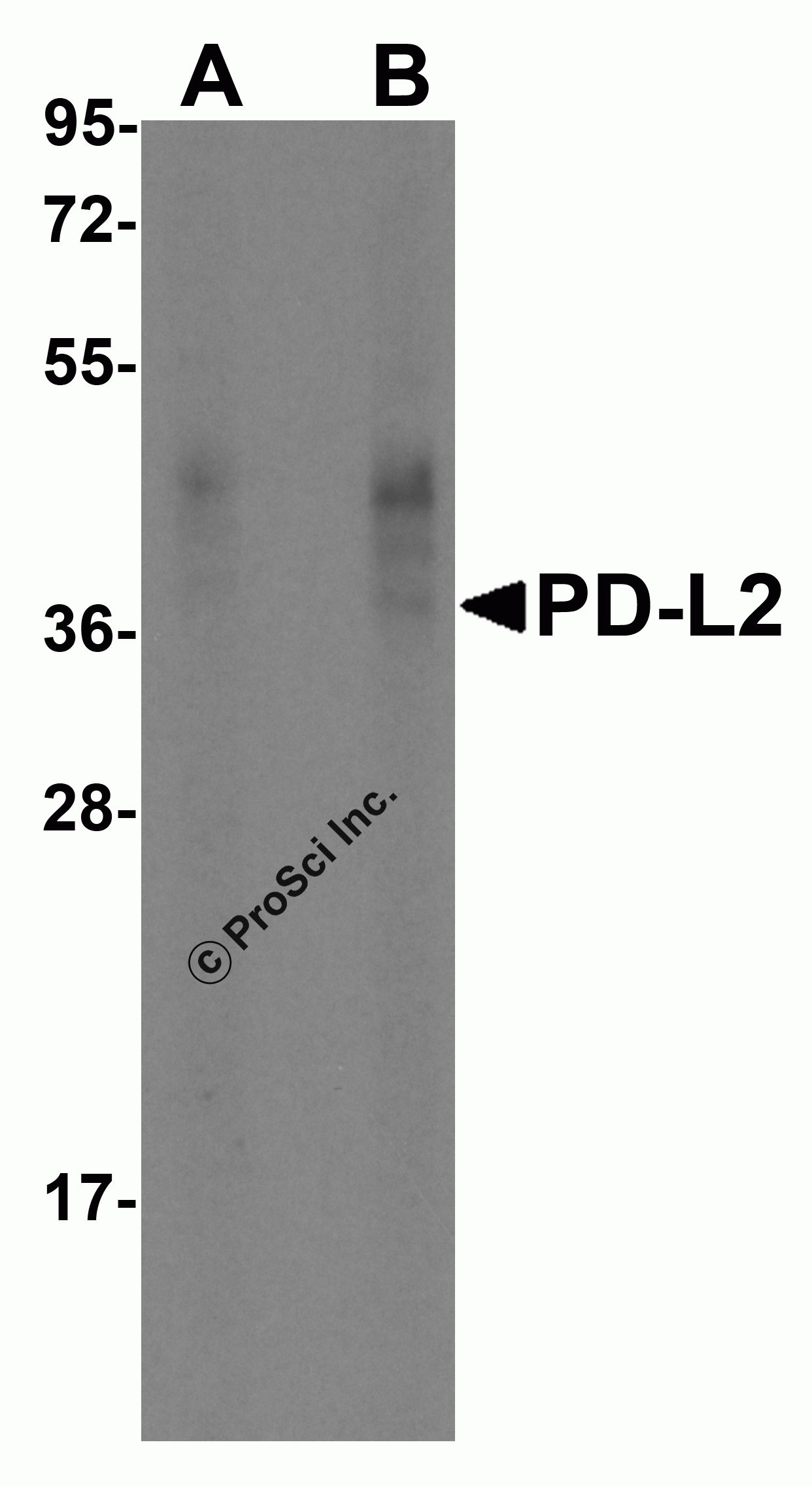 PD-L2 Antibody [7C1] - Cat. No. RF16024 | ProSci