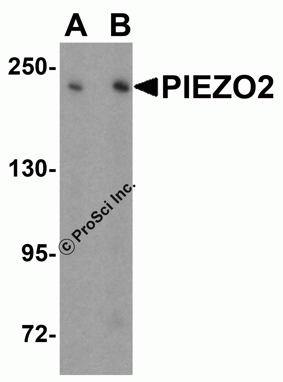 PIEZO2 Antibody - Cat. No. 8613 | ProSci