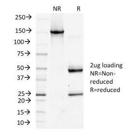 Podoplanin Antibody [PDPN/1433] - Cat. No. 33-758 | ProSci