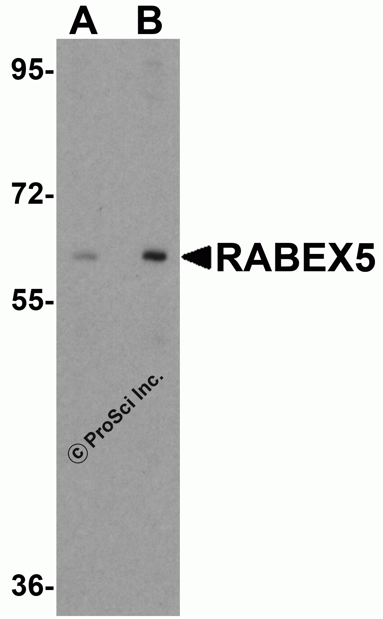 RABEX5 Antibody - Cat. No. 6225 | ProSci