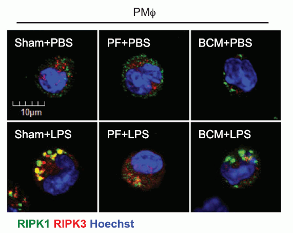 RIP3 Antibody - Cat. No. 2283 | ProSci