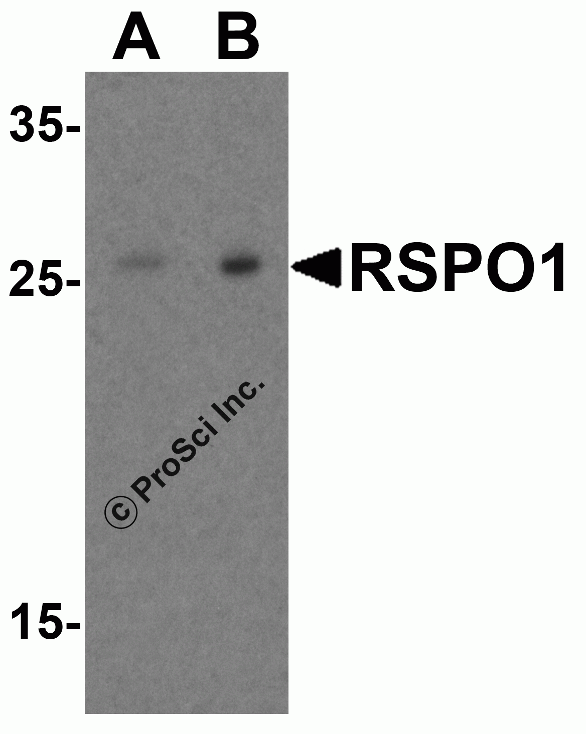 RSPO1 Antibody - Cat. No. 5171 | ProSci