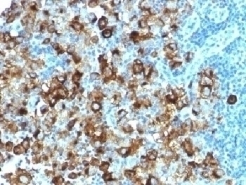 Recombinant PMEL17 / Melanoma gp100 Antibody [PMEL/1825R] - Cat. No. 33 ...
