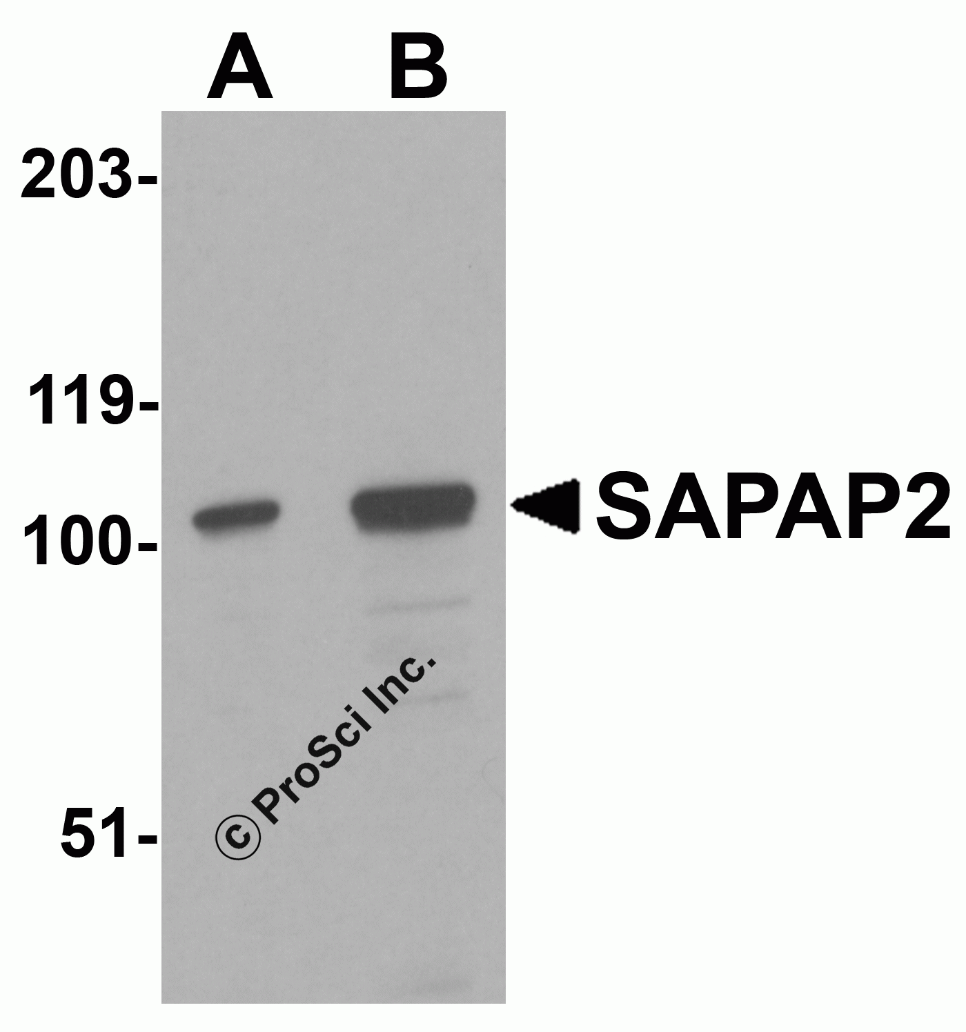 SAPAP Detection Set - Cat. No. PSI-1826 | ProSci