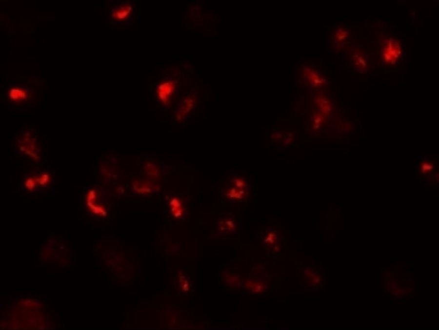 SLAMF3 Antibody - Cat. No. 6251 | ProSci