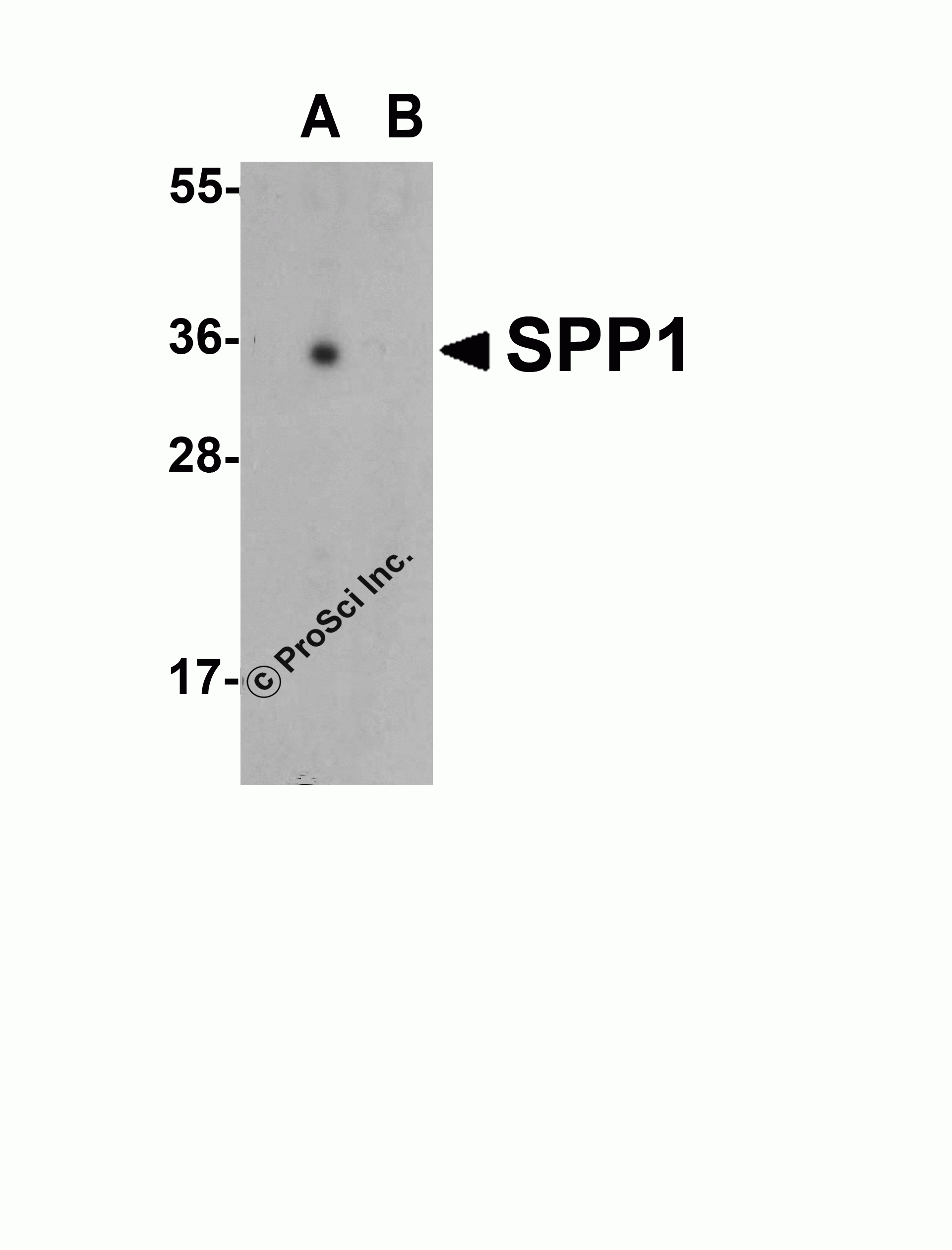 SPP1 Antibody - Cat. No. 7443 | ProSci