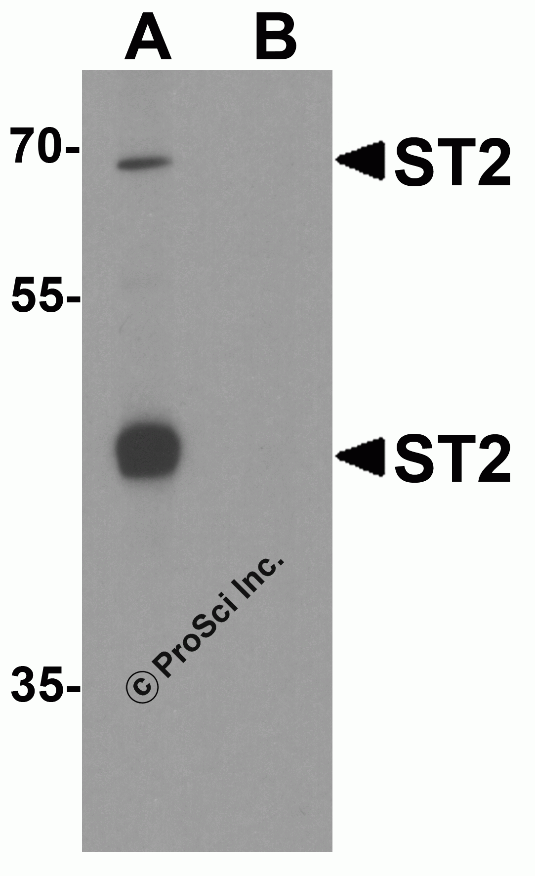 ST2 Peptide - Cat. No. 3363P | ProSci
