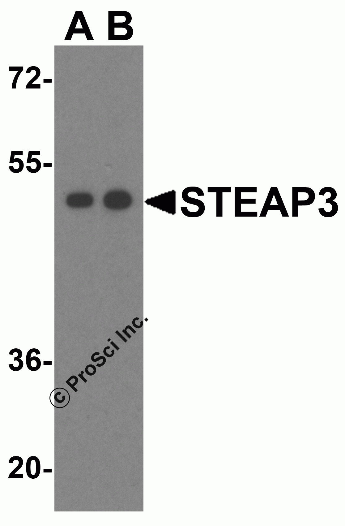 STEAP3 Antibody - Cat. No. 4311 | ProSci