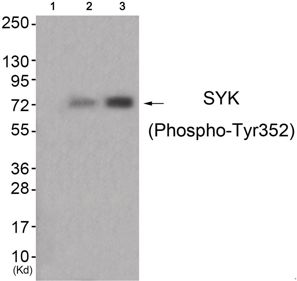 SYK (phospho Tyr352) Antibody - Cat. No. 79-936 | ProSci