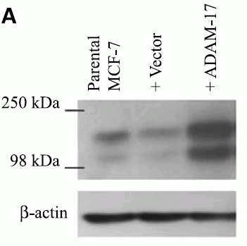 TACE Antibody - Cat. No. 1131 | ProSci