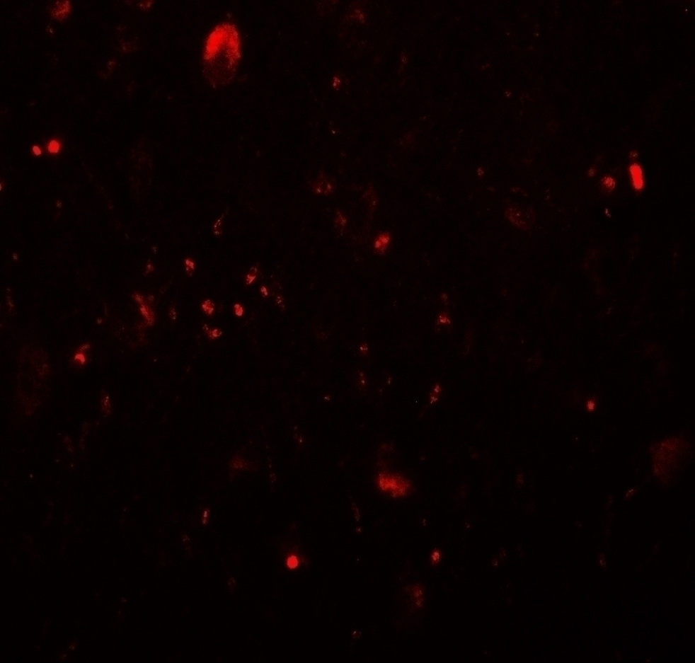 TET3 Antibody - Cat. No. 7013 | ProSci