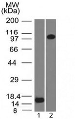 Thrombomodulin Antibody [THBD/1591] - Cat. No. 33-761 | ProSci