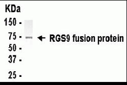 RGS9 Antibody - Cat. No. XW-7538 | ProSci