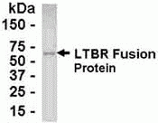 LTBR Antibody - Cat. No. XW-7729 | ProSci
