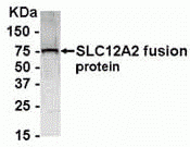 SLC12A2 Antibody - Cat. No. XW-8138 | ProSci