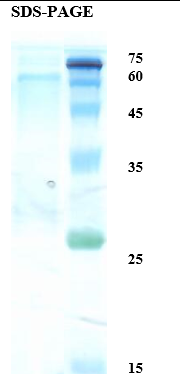 Herpes Simplex Virus Type 1 (HSV-1) Glycoprotein G Recombinant Protein ...