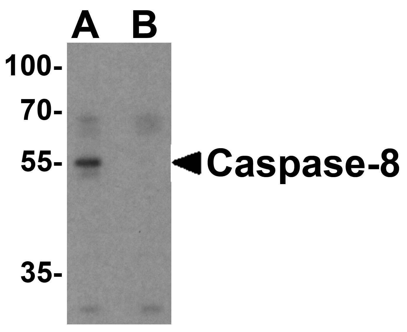 Caspase-8 Antibody - Cat. No. 3473 | ProSci