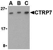 Adipokines: Adiponectin and CTRPs 1-7 Detection Set - Cat. No. PSI-1804 | ProSci