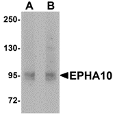 EphA10 Antibody - Cat. No. 5253 | ProSci