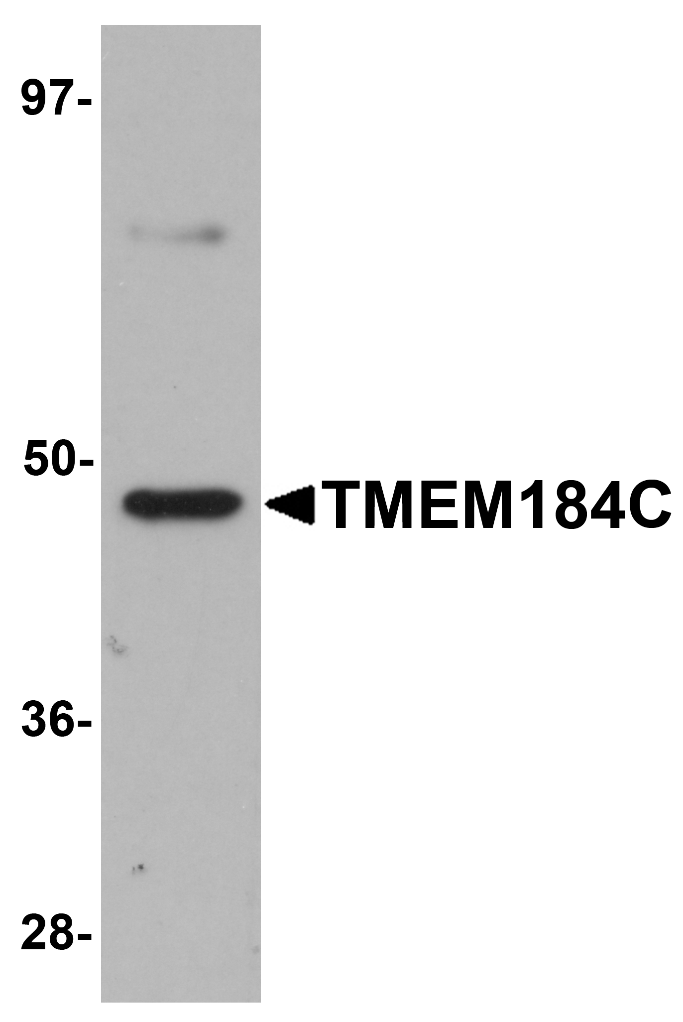 TMEM184C Antibody - Cat. No. 5685 | ProSci