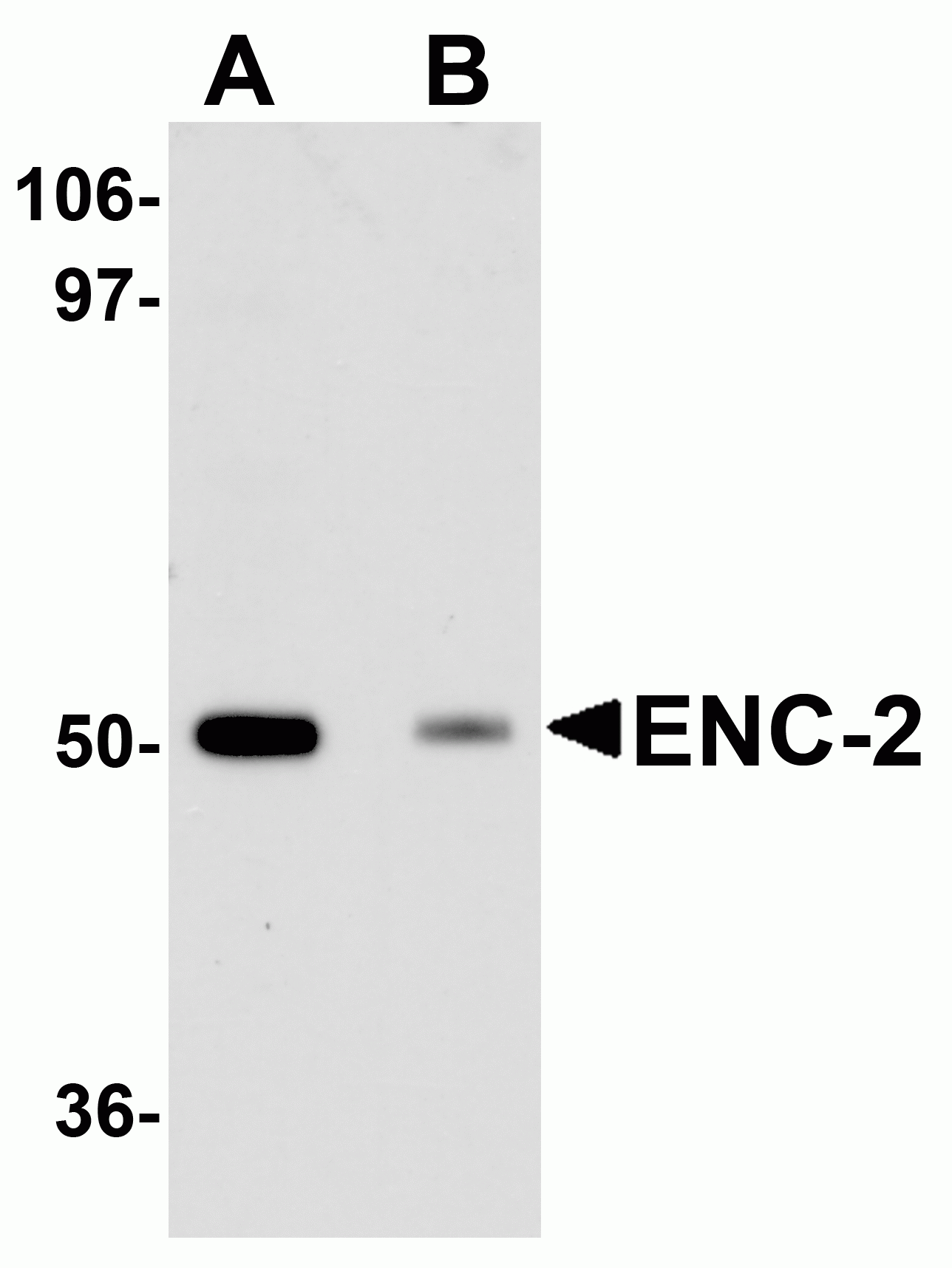 ENC-2 Antibody - Cat. No. 5695 | ProSci