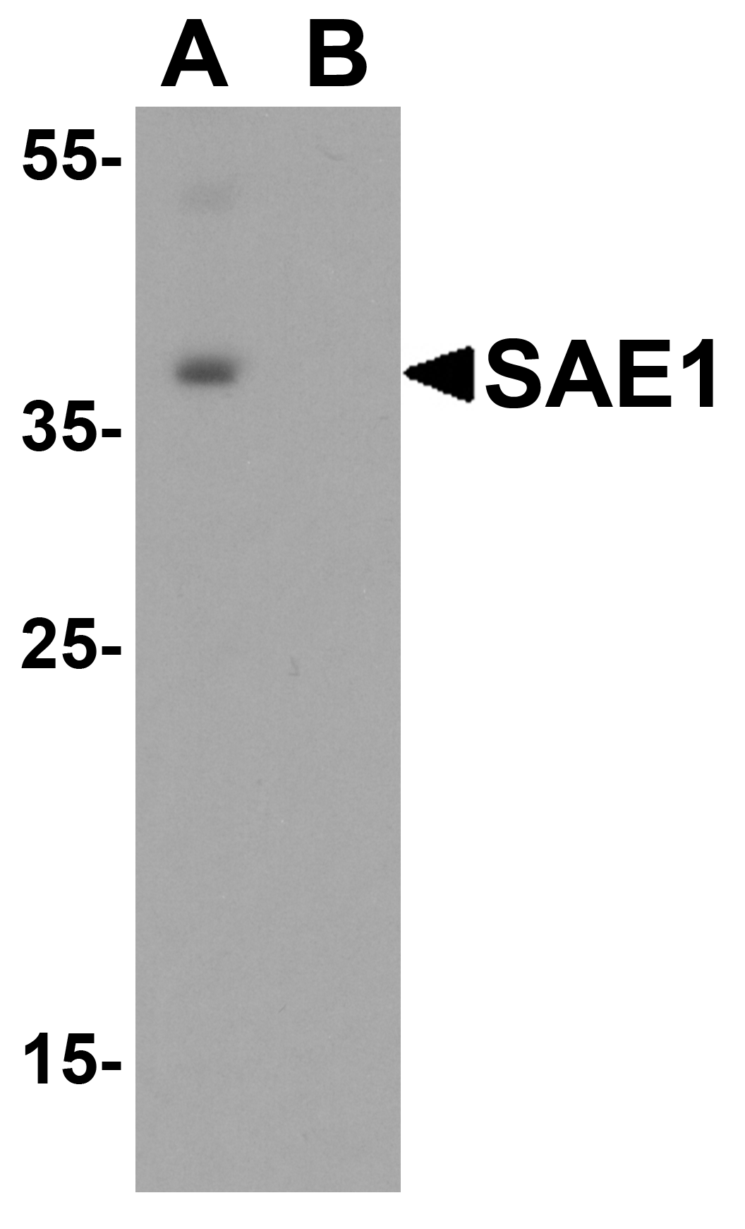 SAE1 Antibody - Cat. No. 5749 | ProSci