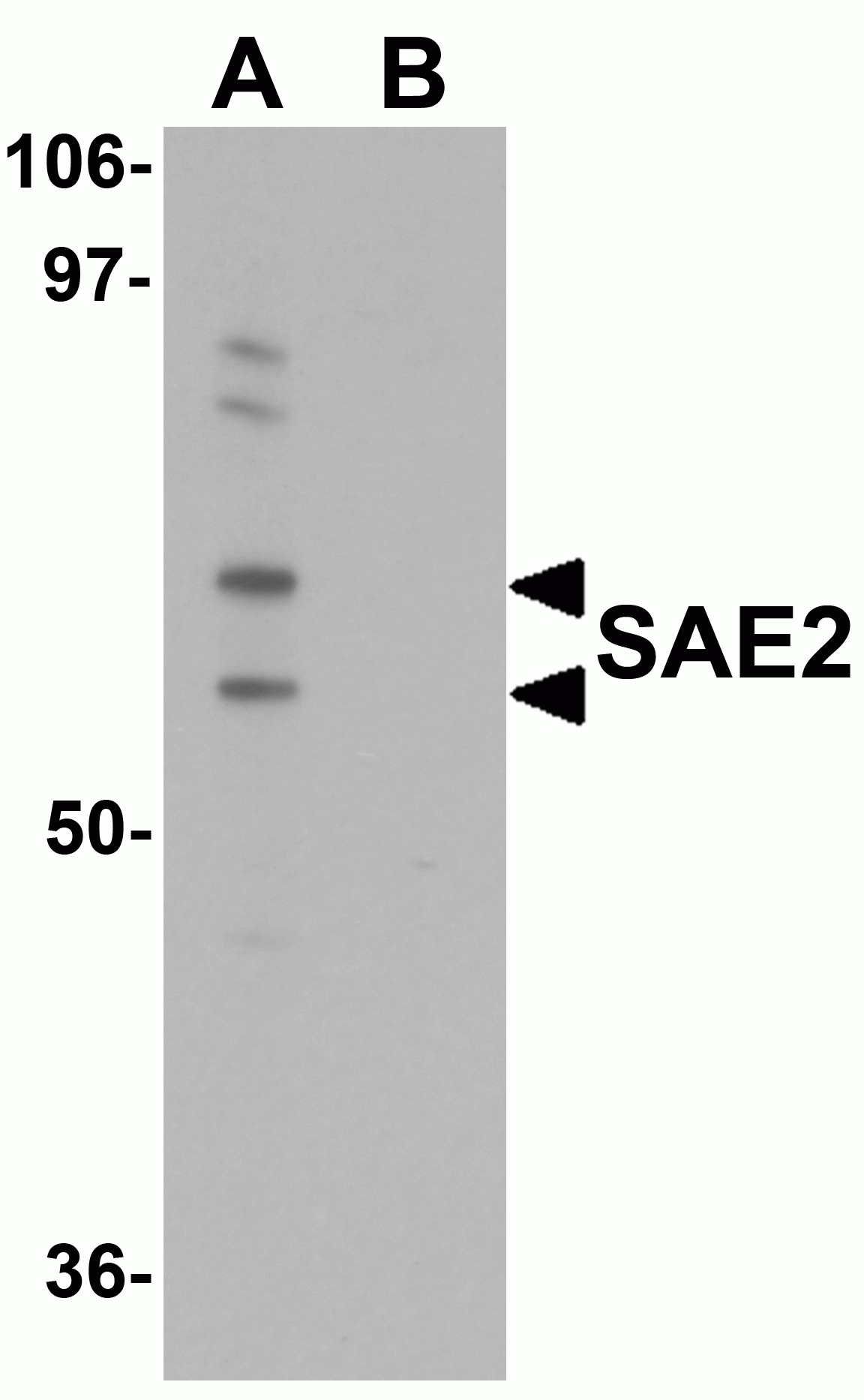 SAE2 Antibody - Cat. No. 5751 | ProSci