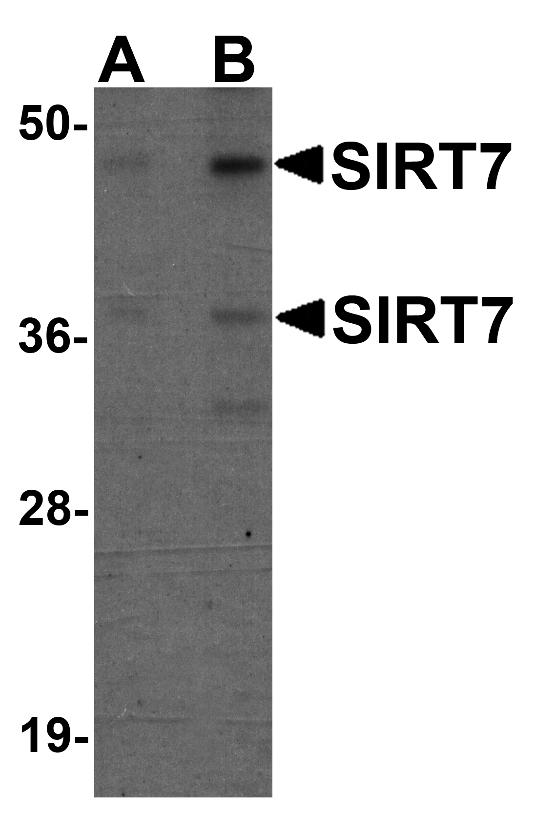 SIRT7 Antibody - Cat. No. 5775 | ProSci