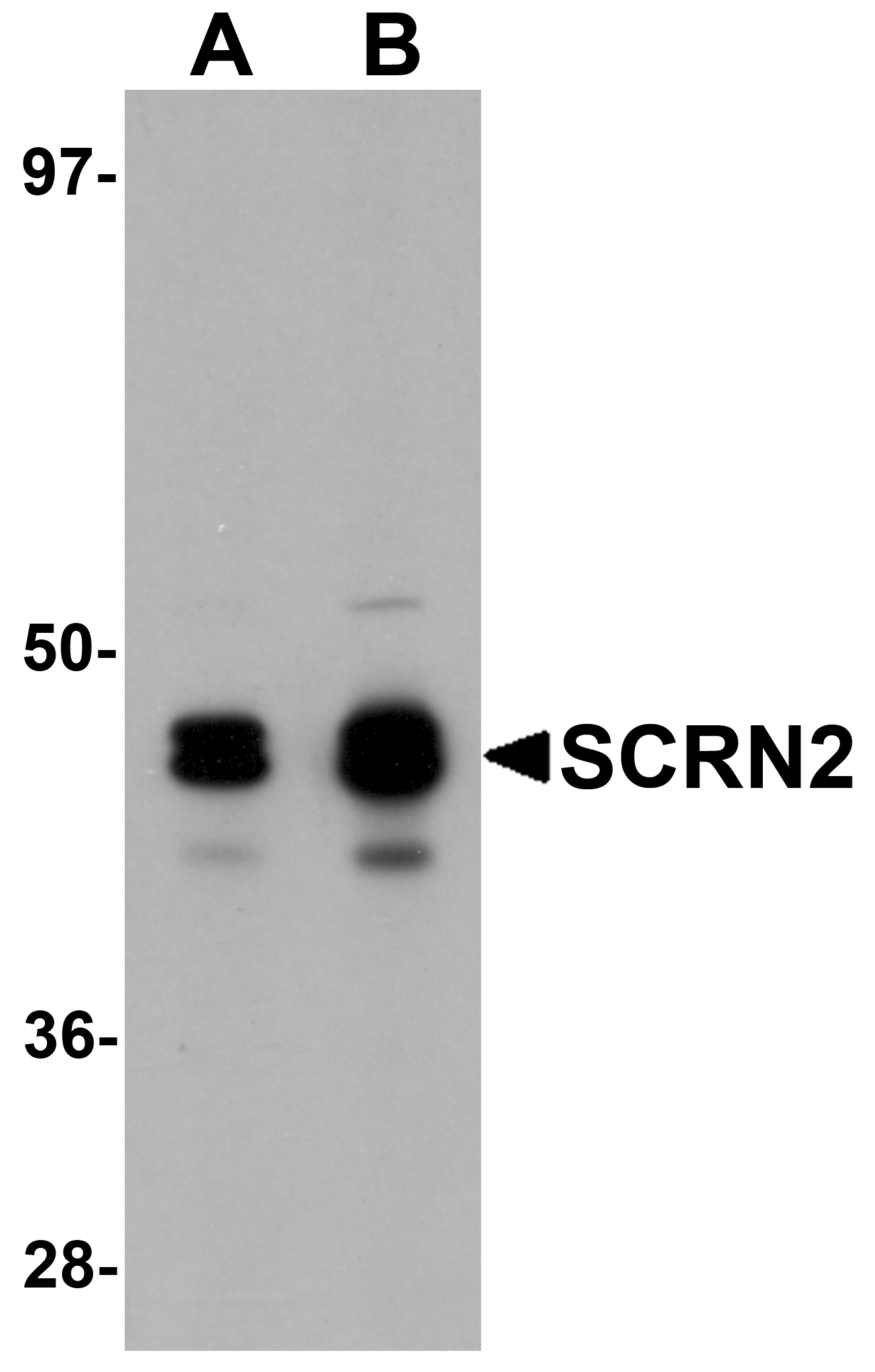 SCRN2 Antibody - Cat. No. 5851 | ProSci