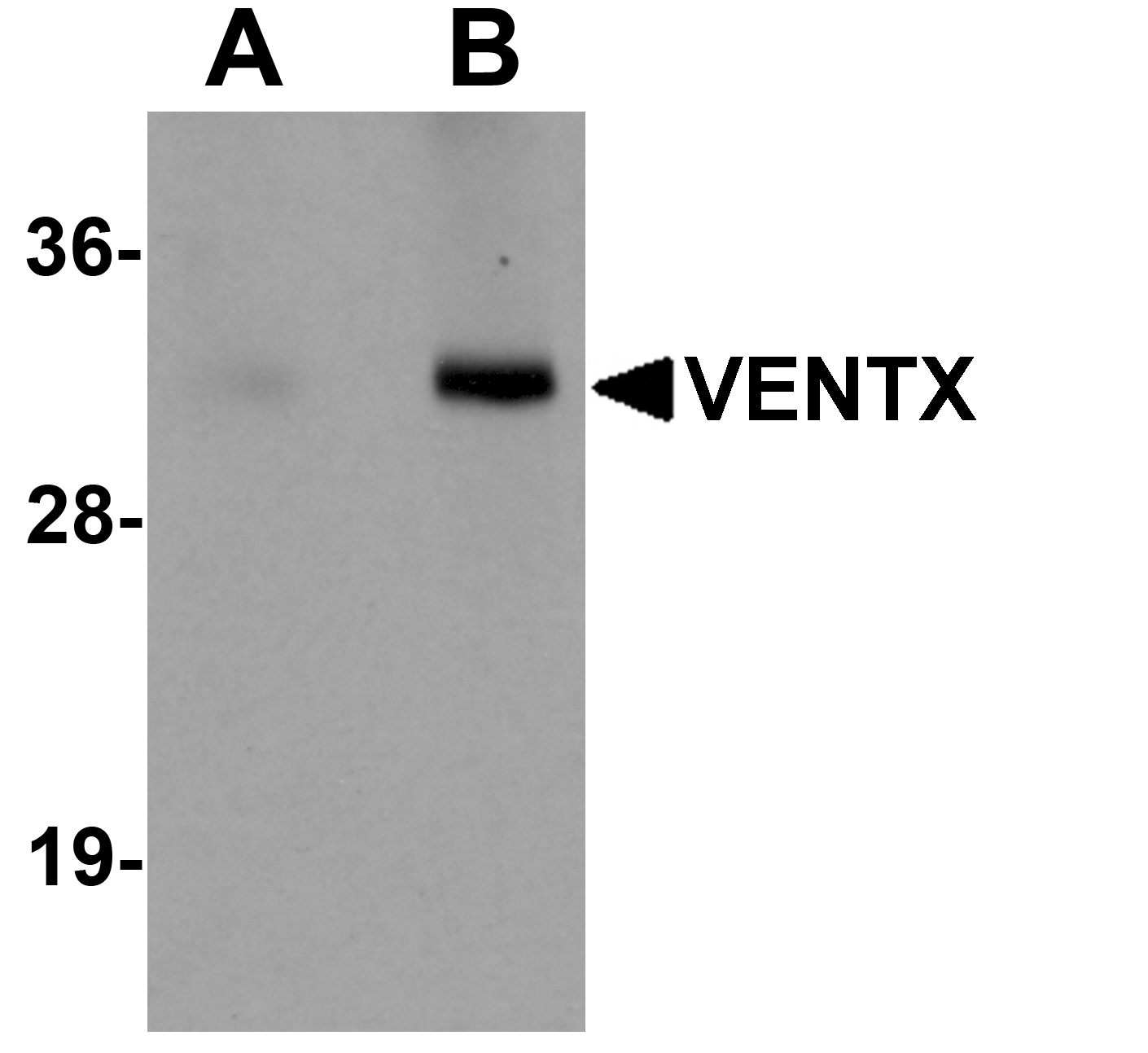 VENTX Antibody - Cat. No. 5863 | ProSci