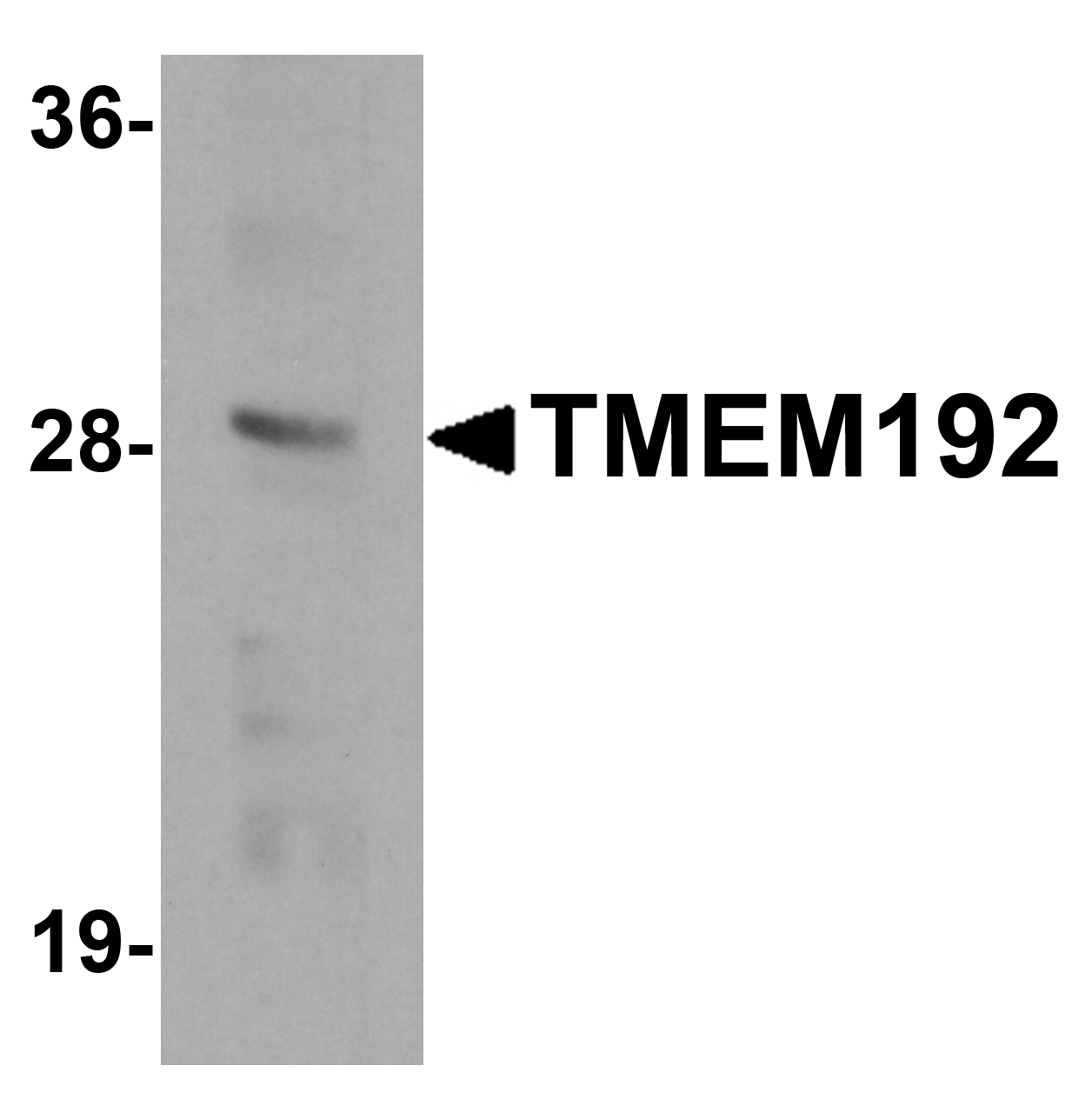 TMEM192 Antibody - Cat. No. 6227 | ProSci
