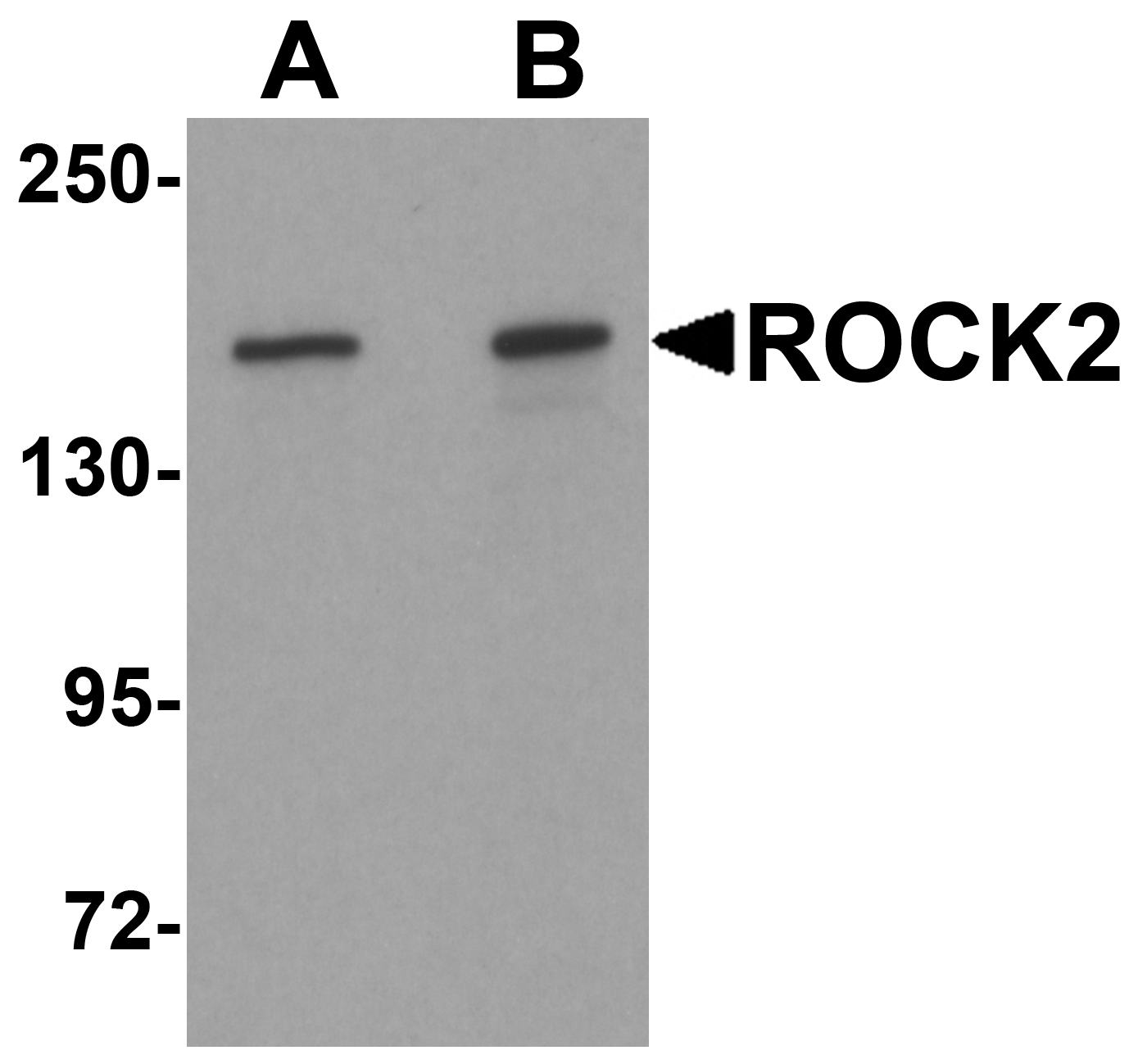 ROCK2 Antibody - Cat. No. 6297 | ProSci
