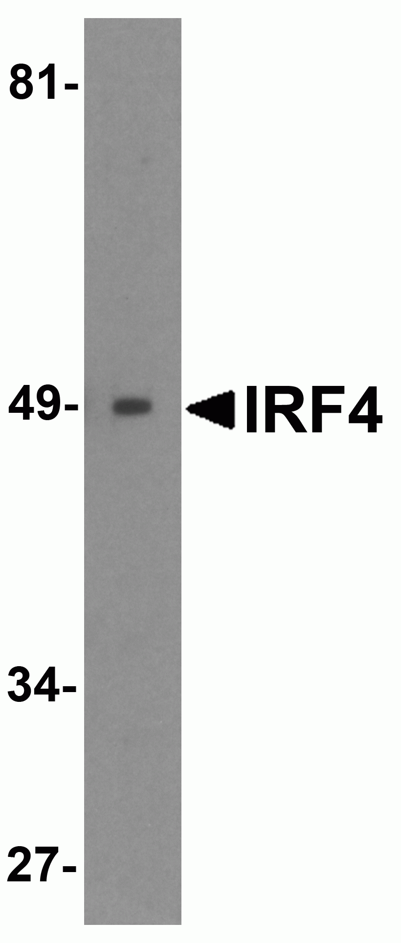 IRF4 Antibody - Cat. No. 6307 | ProSci