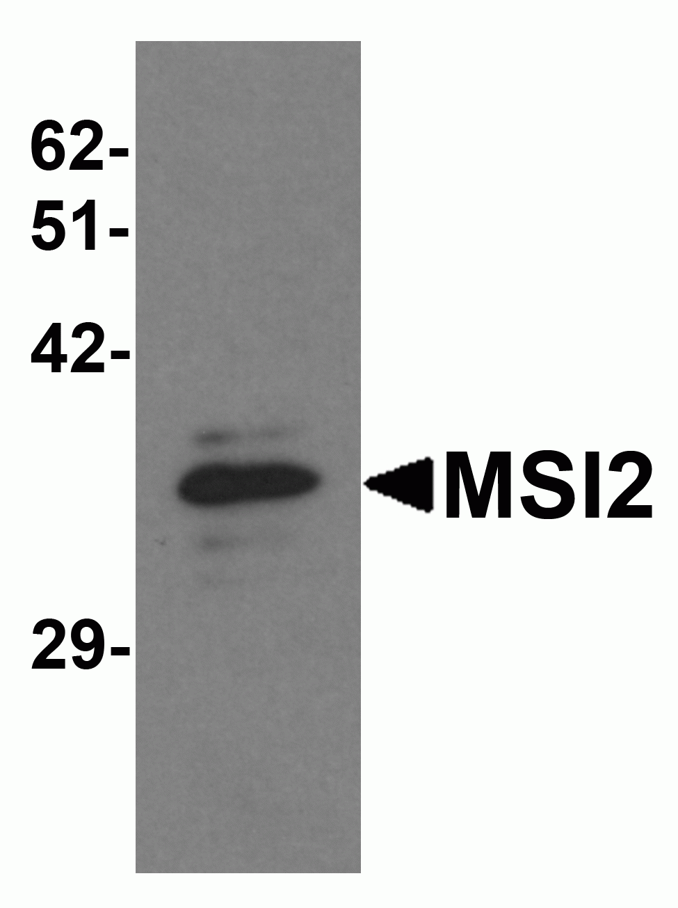 MSI2 Antibody - Cat. No. 6309 | ProSci