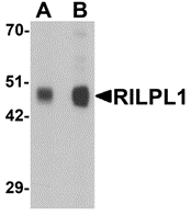 RILPL1 Antibody - Cat. No. 6495 | ProSci