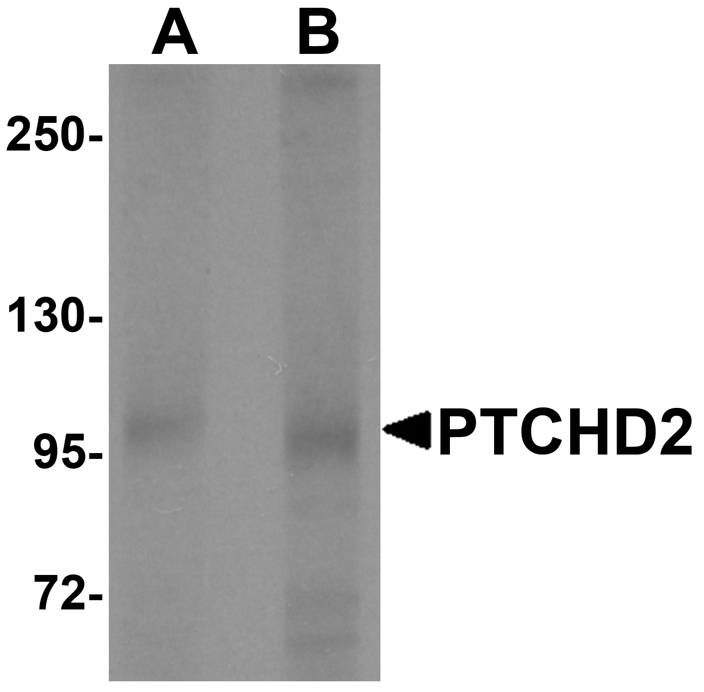PTCHD2 Antibody - Cat. No. 6637 | ProSci
