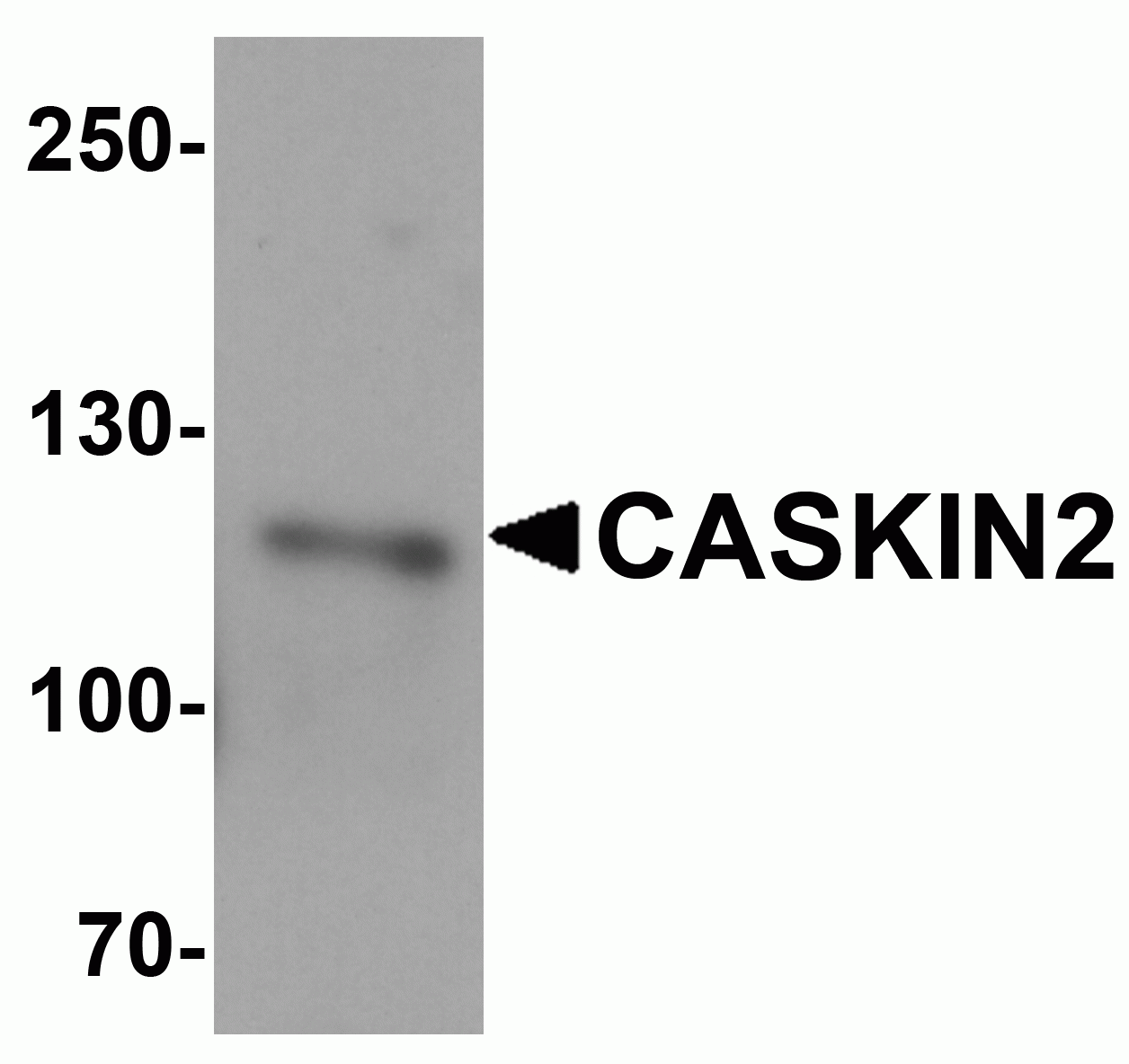 CASKIN2 Antibody - Cat. No. 6663 | ProSci