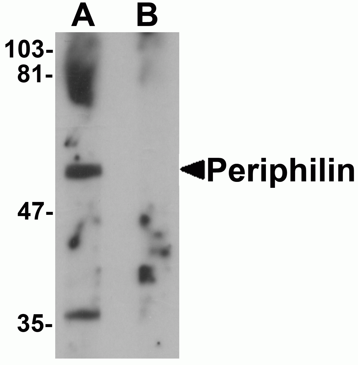 Periphilin Antibody - Cat. No. 6687 | ProSci