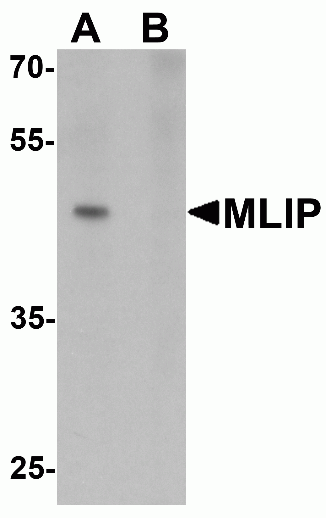 MLIP Antibody - Cat. No. 6719 | ProSci