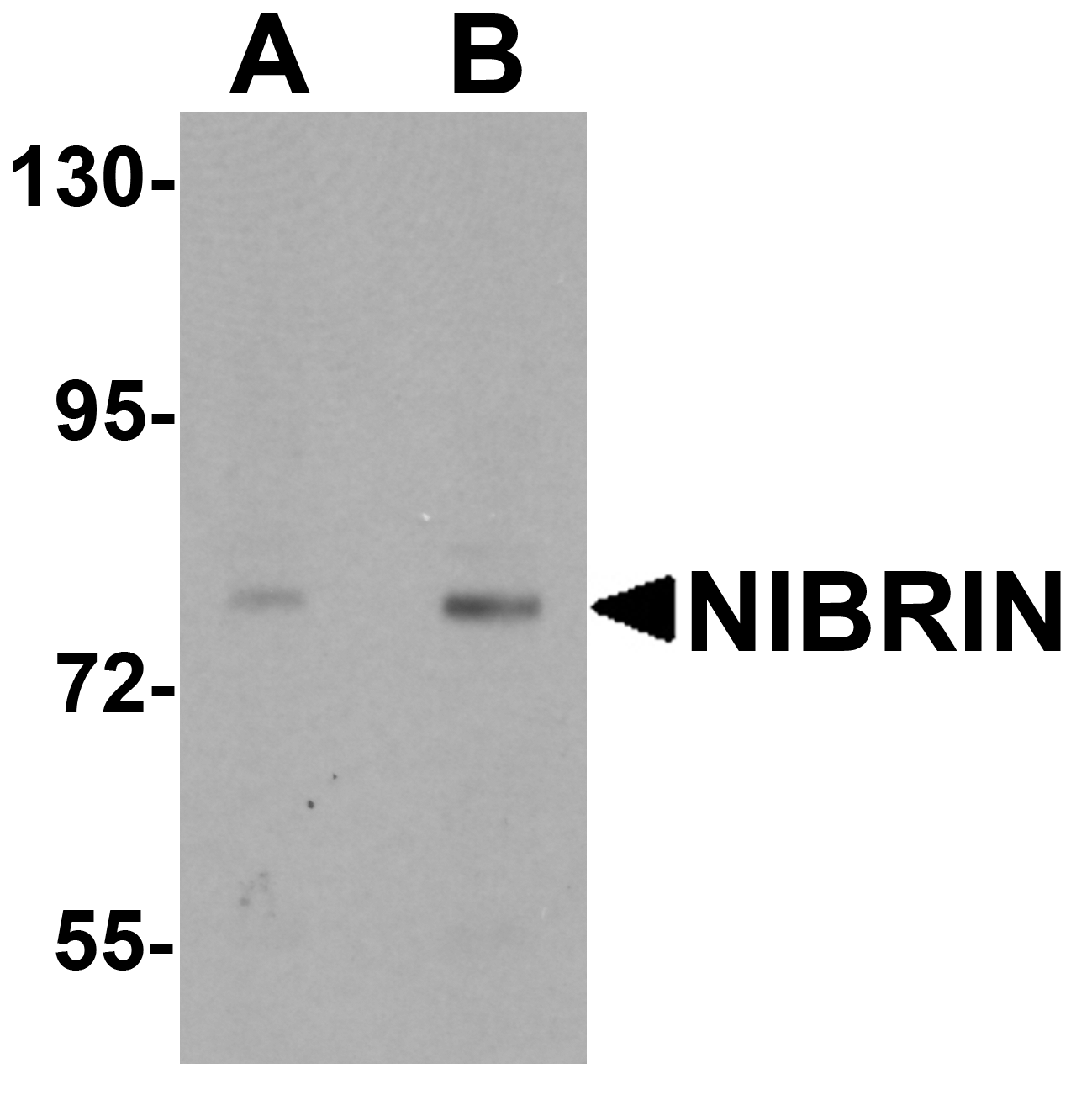 NIBRIN Antibody - Cat. No. 6841 | ProSci