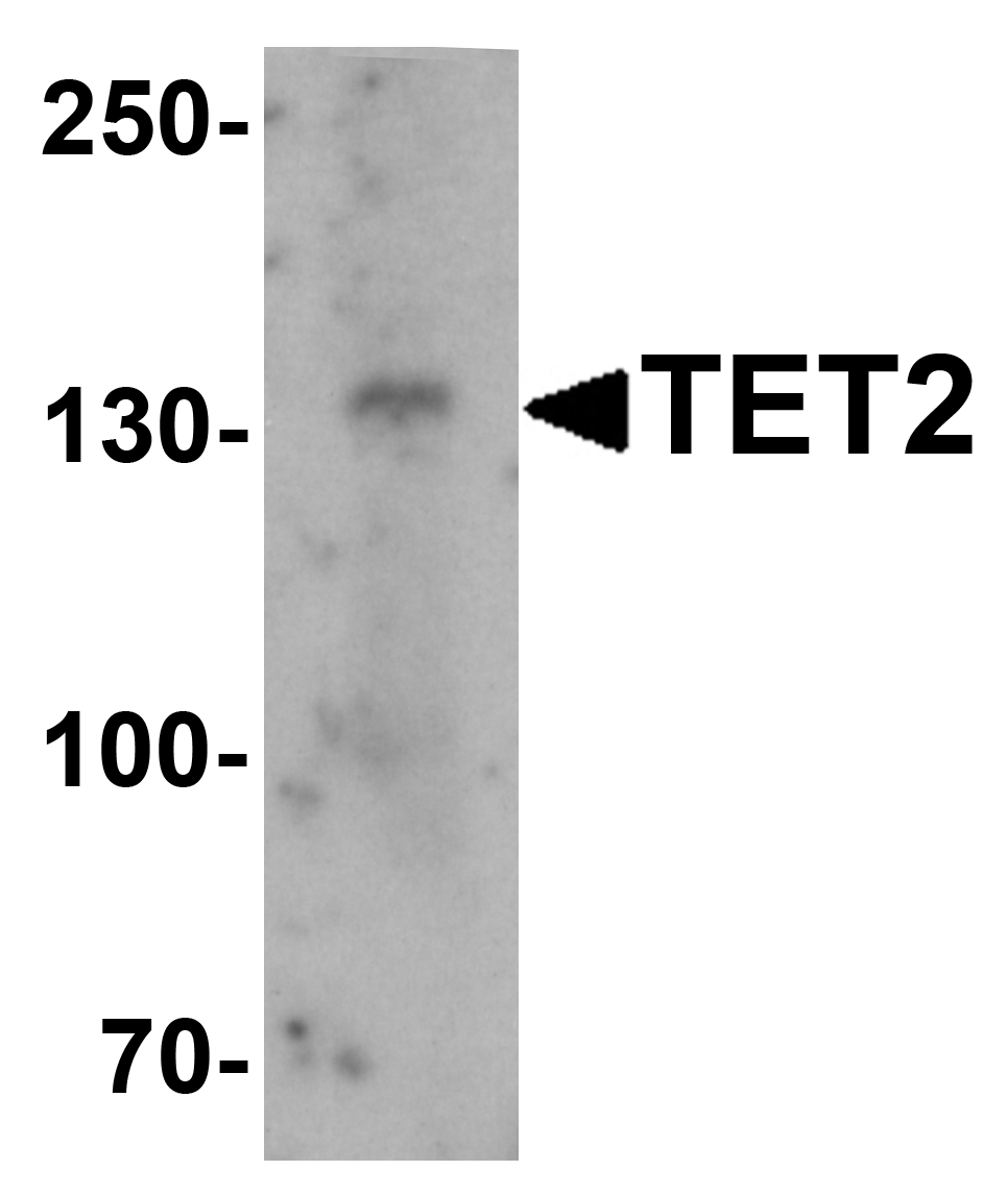 TET2 Antibody - Cat. No. 6915 | ProSci