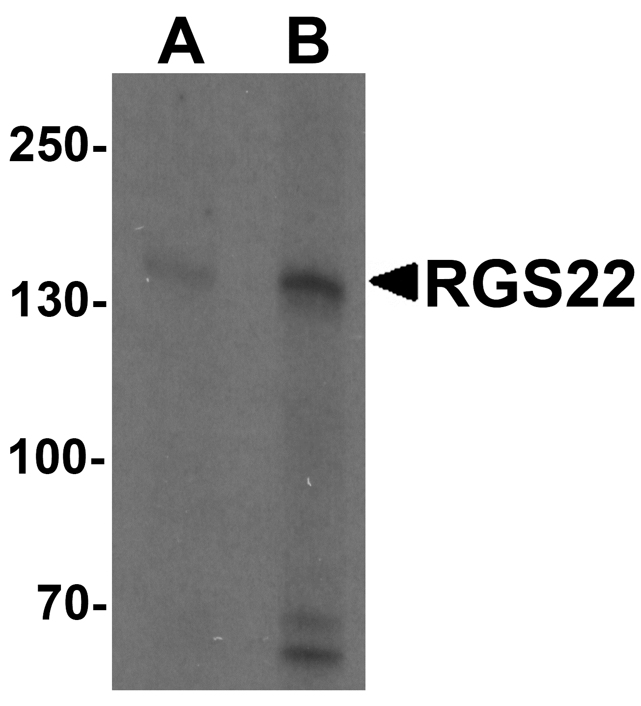RGS22 Antibody - Cat. No. 7001 | ProSci